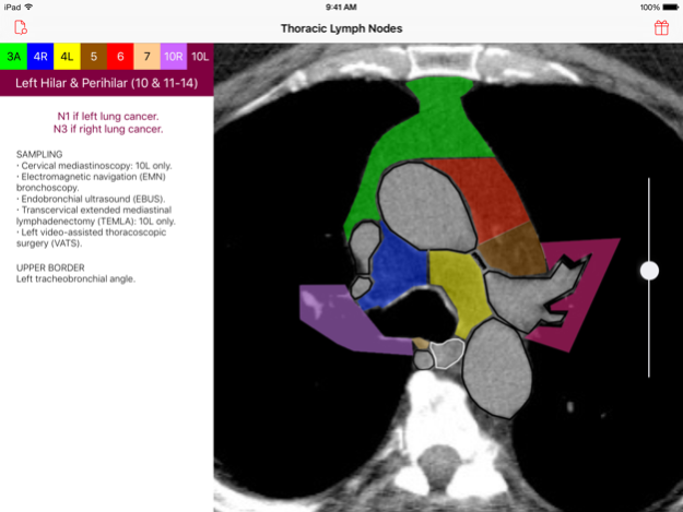 what are lymph node stations