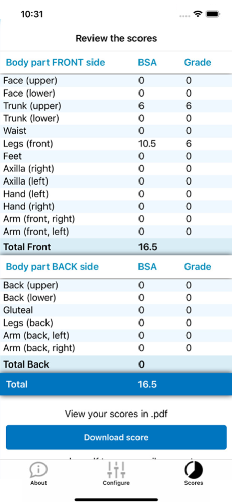 vitiligo scoring system